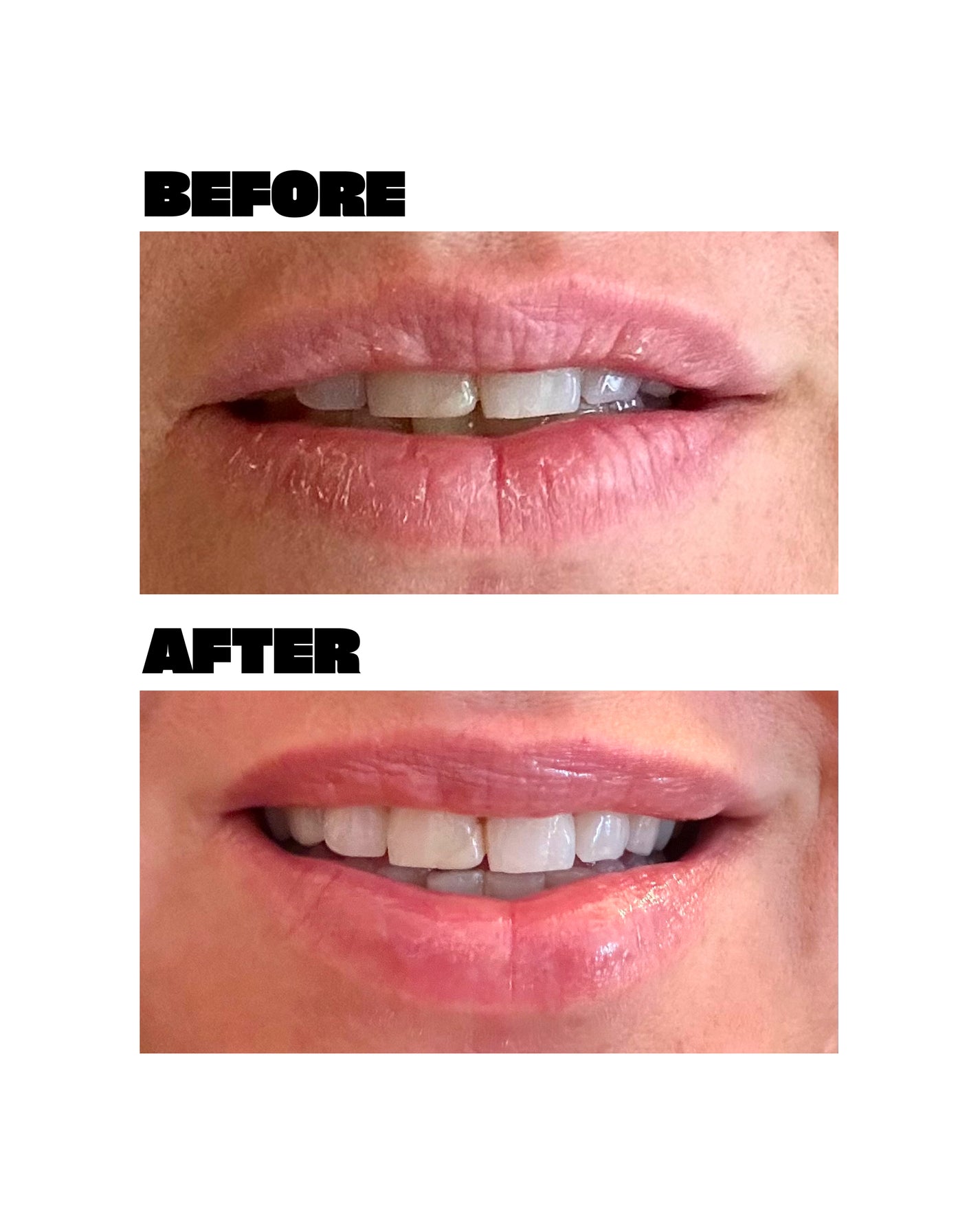 Lip Mask – Babe Original