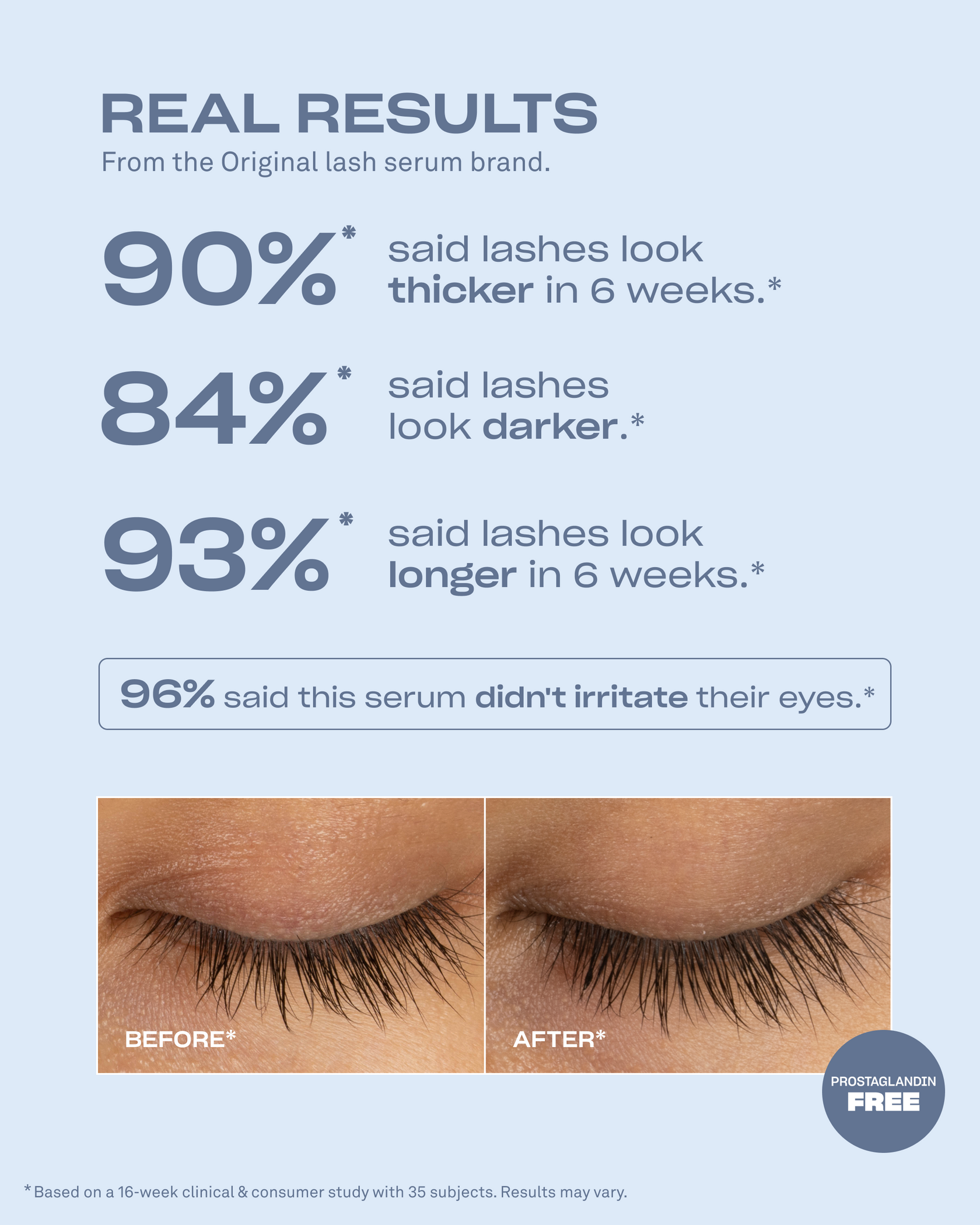 Renewing Lash Serum – Babe Original