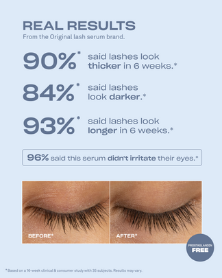 Renewing Lash Serum – Babe Original